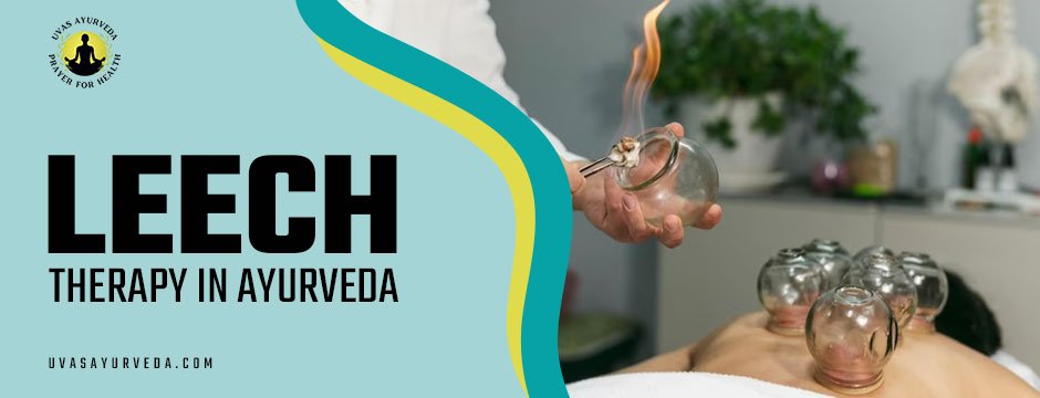 Leech Therapy in Ayurveda | Uvas Ayurveda